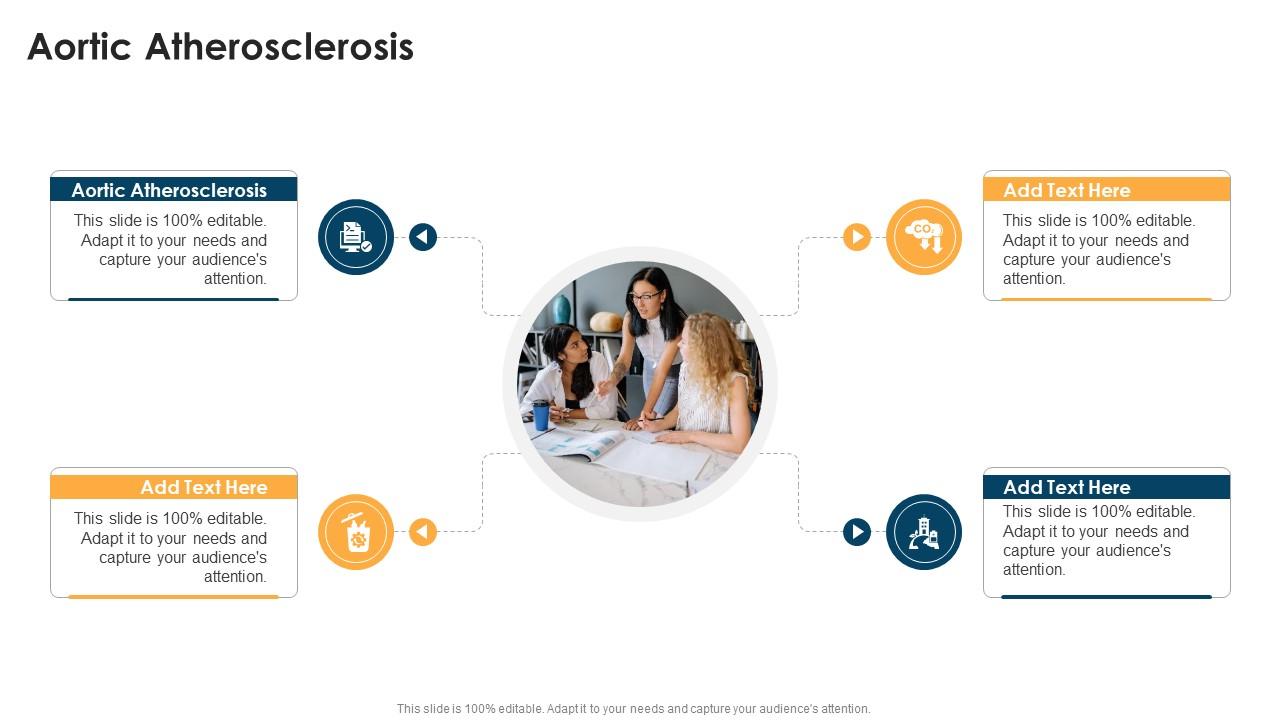 Aortic Atherosclerosis In Powerpoint And Google Slides Cpb