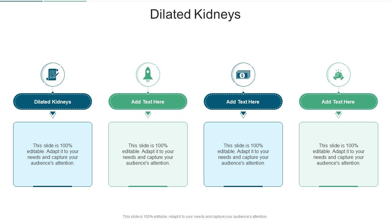 Dilated Kidneys In Powerpoint And Google Slides Cpb